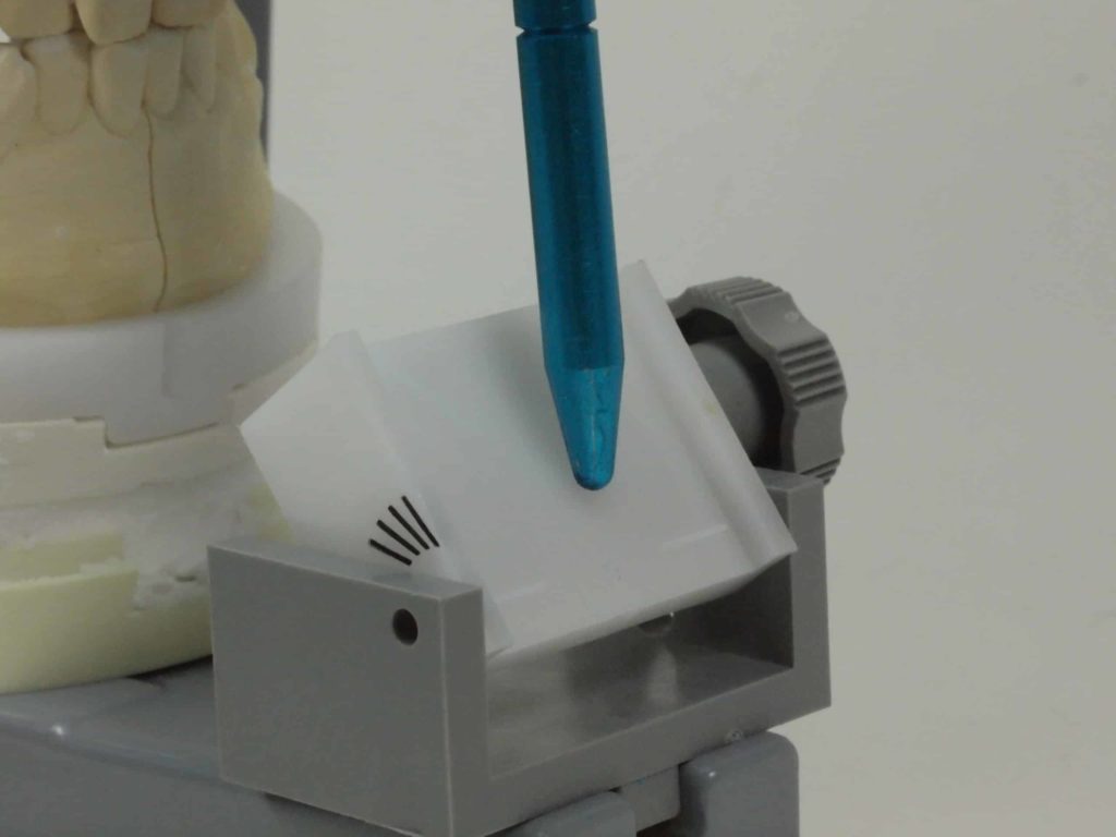 Adjustable incisal table - FAG Dentaire